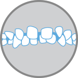 spaces-between-teeth | Tardy Orthodontics